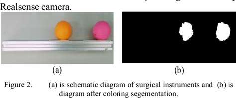 Figure 2 From Surgical Navigation System Based On The Visual Object