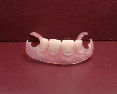 Flexible Partial Dentures