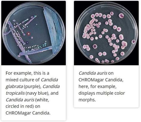 美國致命真菌肆虐「病症超像感冒」 密西根州發病破百例 生活 Ctwant