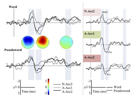 Figure 2 From Perception Of Prosodic Modulations Of Linguistic And Paralinguistic Origin