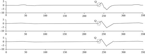 Example Of Time Series Compression From Top To Bottom Are The
