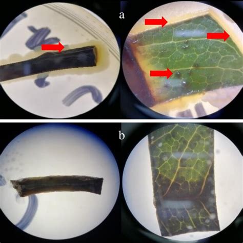 Observation Of Plant Tissues Through The Stereoscope Inoculated Leaf