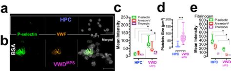 Platelet Clumping In 2b Vwd Of The Original Montreal Platelet Syndrome Download Scientific