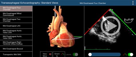 Transesophageal Echocardiogram Views