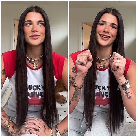Model Reveals All The Plastic Surgery She Got For 54000