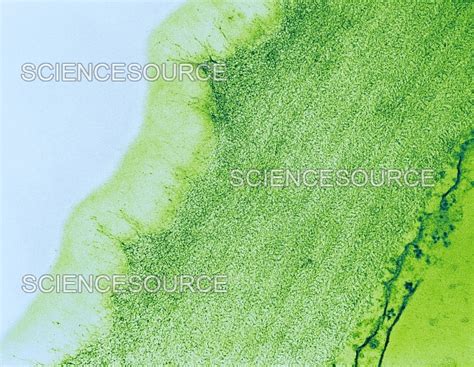 Celery Cells Under Microscope