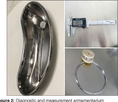 Figure 2 From Reliability Of Odontometric Parameters In Stature Analysis Semantic Scholar