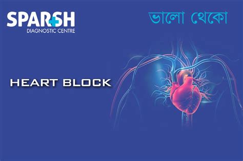 Heart Block Sparsh Diagnostic Center