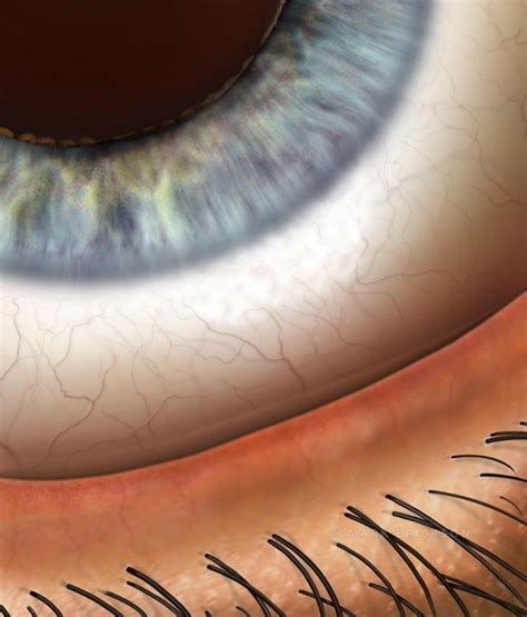 Eyelid Margin Closeup With Lashes Conjunctiva And Iris