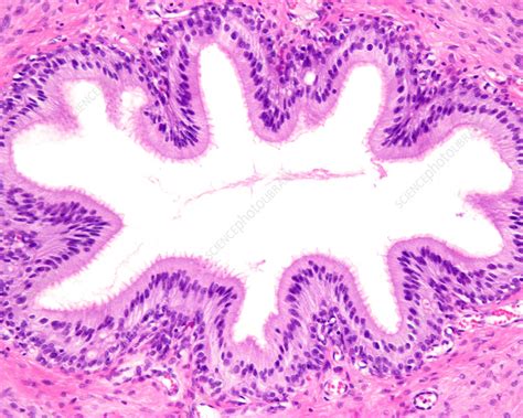 Vas Deferens Histology