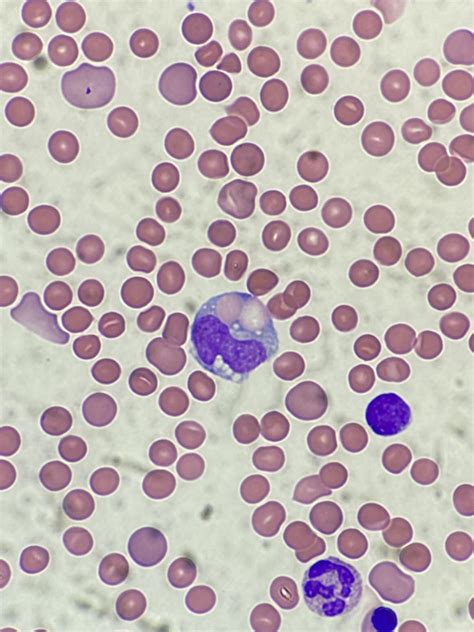 When I Receive An Order For A C Diff Test But The Stool Is Formed R