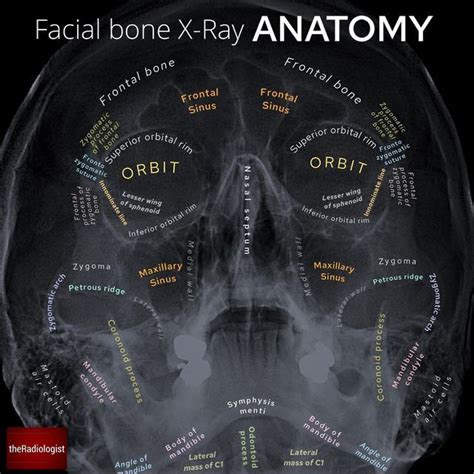 Radiographic Anatomy Of Facial Bones And Mandible With Radiological