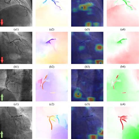 Saliency Maps Of The Spatial Learning Module A1 D1 Certain Frames