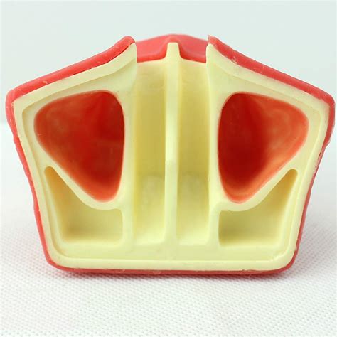 Buy Educational Model Oral Dental Im Surgery Maxillary Maxillary Sinus