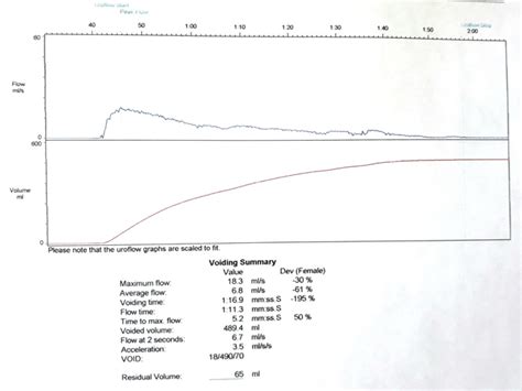 Uroflow Urine Rate Flow Test 尿液流速测试