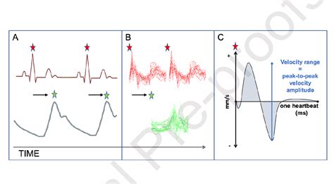 Table 1 From Spinal Cord Motion Assessed By Phase Contrast Mri An Inter Center Pooled Data