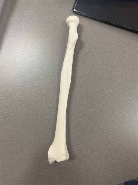 Radius Diagram Quizlet