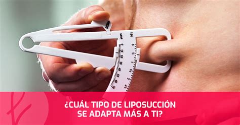 ¿cual Tipo De Liposucción Se Adapta Más A Ti Dr Edwin Vásquez Phd