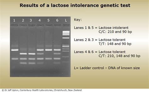 Results Of A Lactose Intolerance Genetic Test — Science Learning Hub