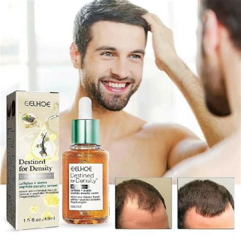 Eelhoe চুল বৃদ্ধির তেল চুল পড়া কমায় এবং নতুন চুল গজাতে সাহায্য করে