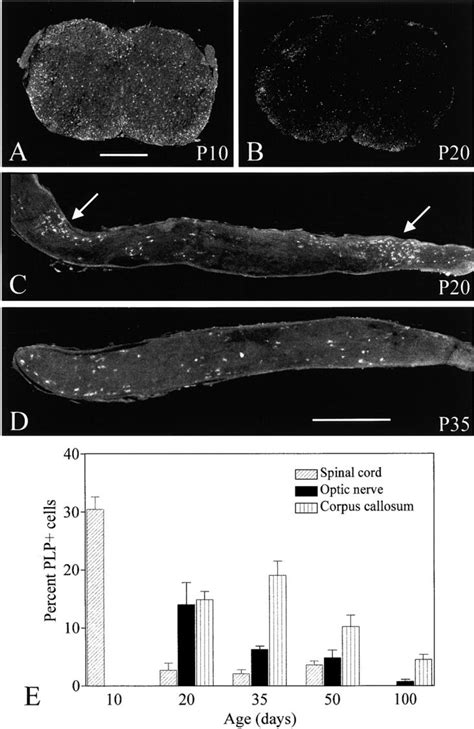 Female Compound Heterozygotes Expressing Jimpy And Null Alleles Of The
