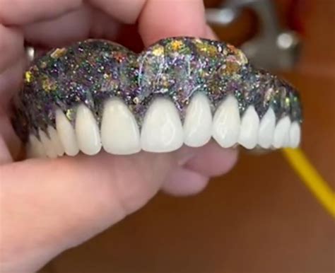 Glitter Dentures For A Dazzling Smile Ratbge