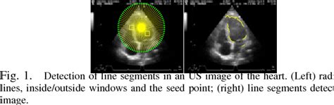 Figure 2 From Improved Gradient Vector Flow For Robust Shape Estimation