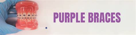 Light Purple Braces Before And After