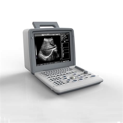 Full Digital Ob Gyn Usg Scan Machine 0 To 120db 12in Led Display