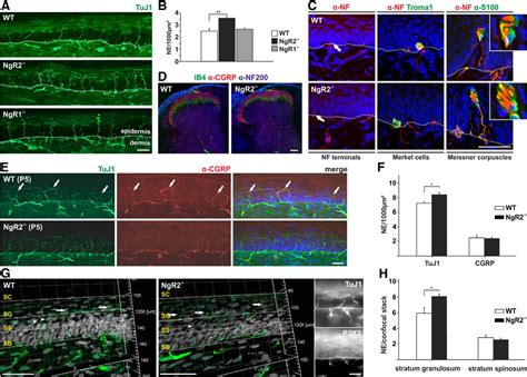 Nogo Receptor Homolog Ngr2 Expressed In Sensory Drg Neurons Controls