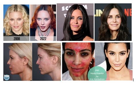 Celebrity Facial 60 Photos Moonagedaydream Film