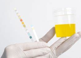Warna Urine Normal Dan Sehat Yang Penting Dikenali