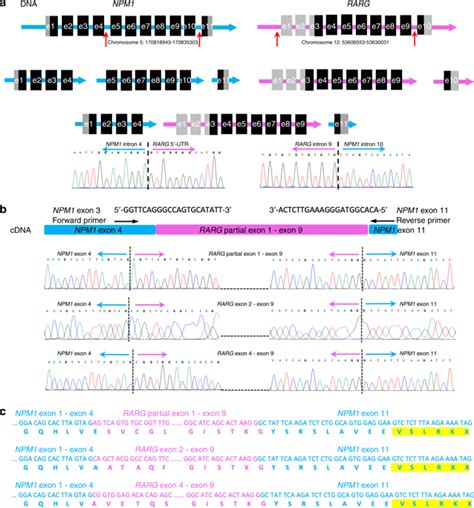 A Novel Npm1 Rarg Npm1 Chimeric Fusion In Acute Myeloid Leukaemia Resembling Acute Promyelocytic