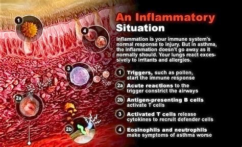 Inflammatory Response