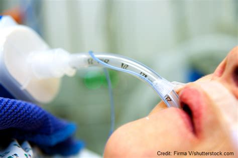 Glasgow Coma Scale GCS Assessment Nursing NCLEX Review