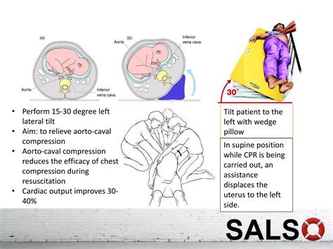 Maternal Resuscitation 2018 Pptx