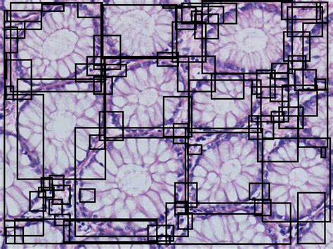 Immunohistochemistryihc Image Analysis Toolbox