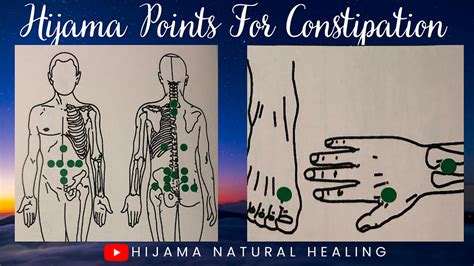 Benefits Of Hijama Points No 7 8 9 And 10 Hijama Natural Healing