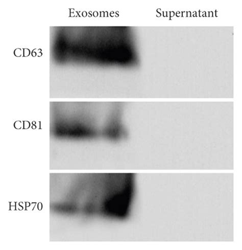 Cafs Derived Exosomes Cafs Exo Facilitated Macrophage M2