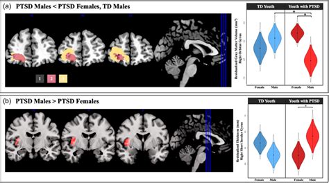 Sex‐based Variations In Brain Structure Among Youth With Posttraumatic Download Scientific