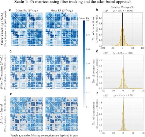 Mean Fa Matrices For Both Acquisitions And The Percentage Of Difference Download Scientific