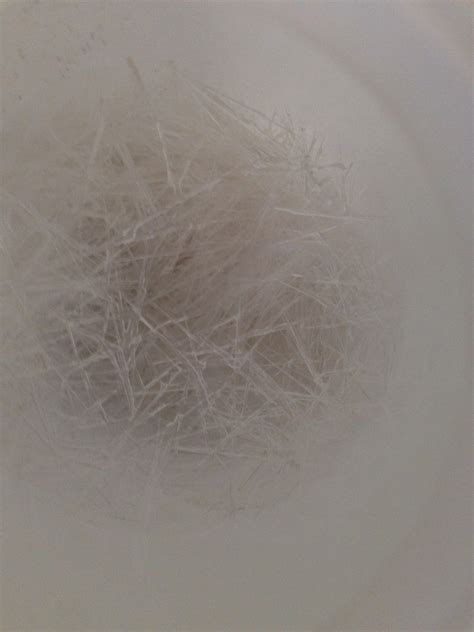 How Can We Prevent Urea Crystals