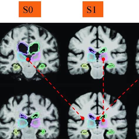 Transposition Of Multi Sequence 3d Medical Image Data Download Scientific Diagram