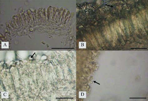 Basidia Cystidia And Basidiospore Of Omphalotus Nidiformis Bo24581