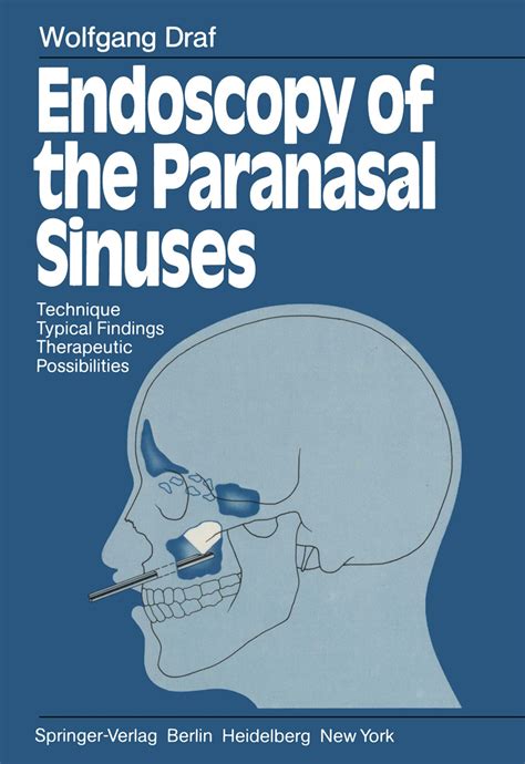 Endoscopy Of The Paranasal Sinuses Ebook By Wolfgang Draf Epub