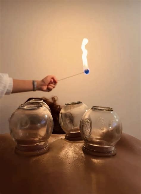 Fire Cupping Therapy In Los Angeles In8love Wellness