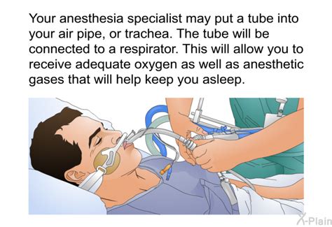 PatEdu Com General Anesthesia