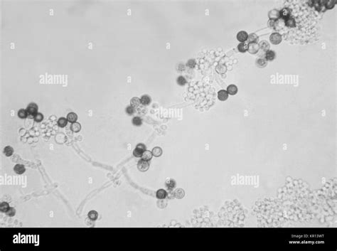 Chlamydospores