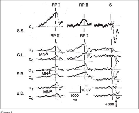 Figure 3 From Benjamin Libet Do We Have Free Will Semantic Scholar