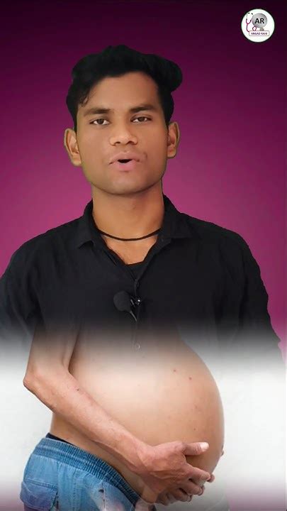 पेट में पानी भर गया 😱😱 Ascites Explain Youtube